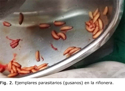 Caso raro de miasis en región facial / A rare case of a patient with ...